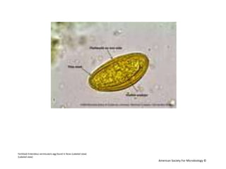 Enterobius Vermicularis Egg