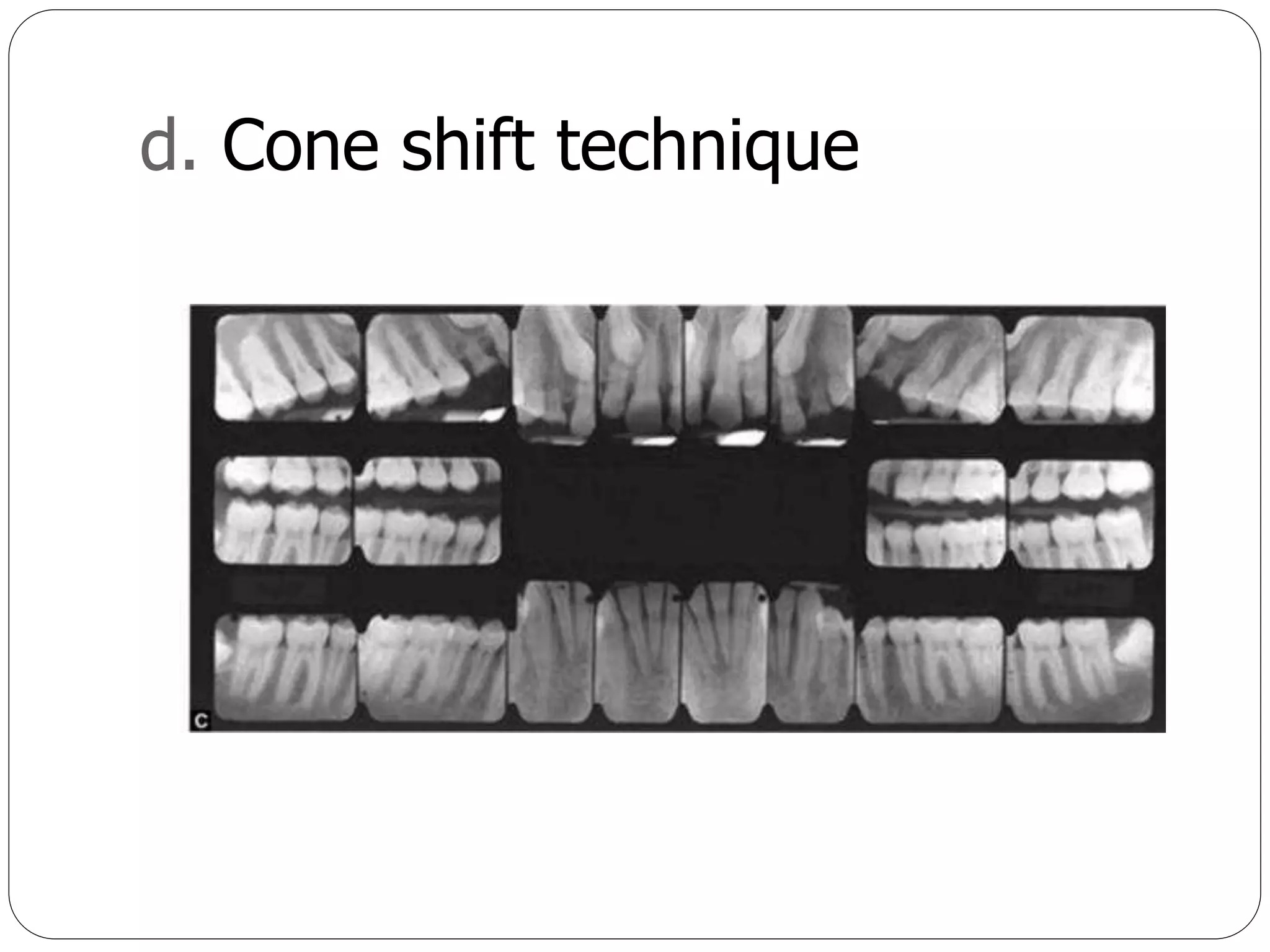 Diagnostic aids in orthodontics | PPTX