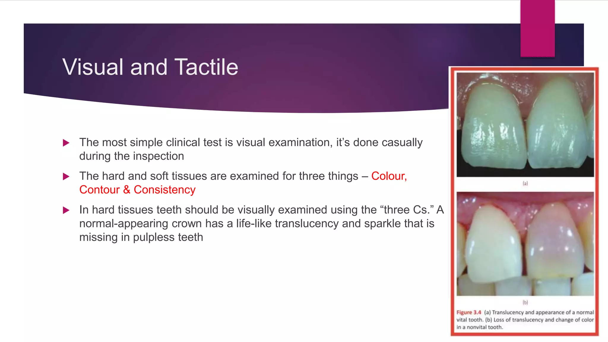 Diagnostic Aids in Endodontics | PPTX