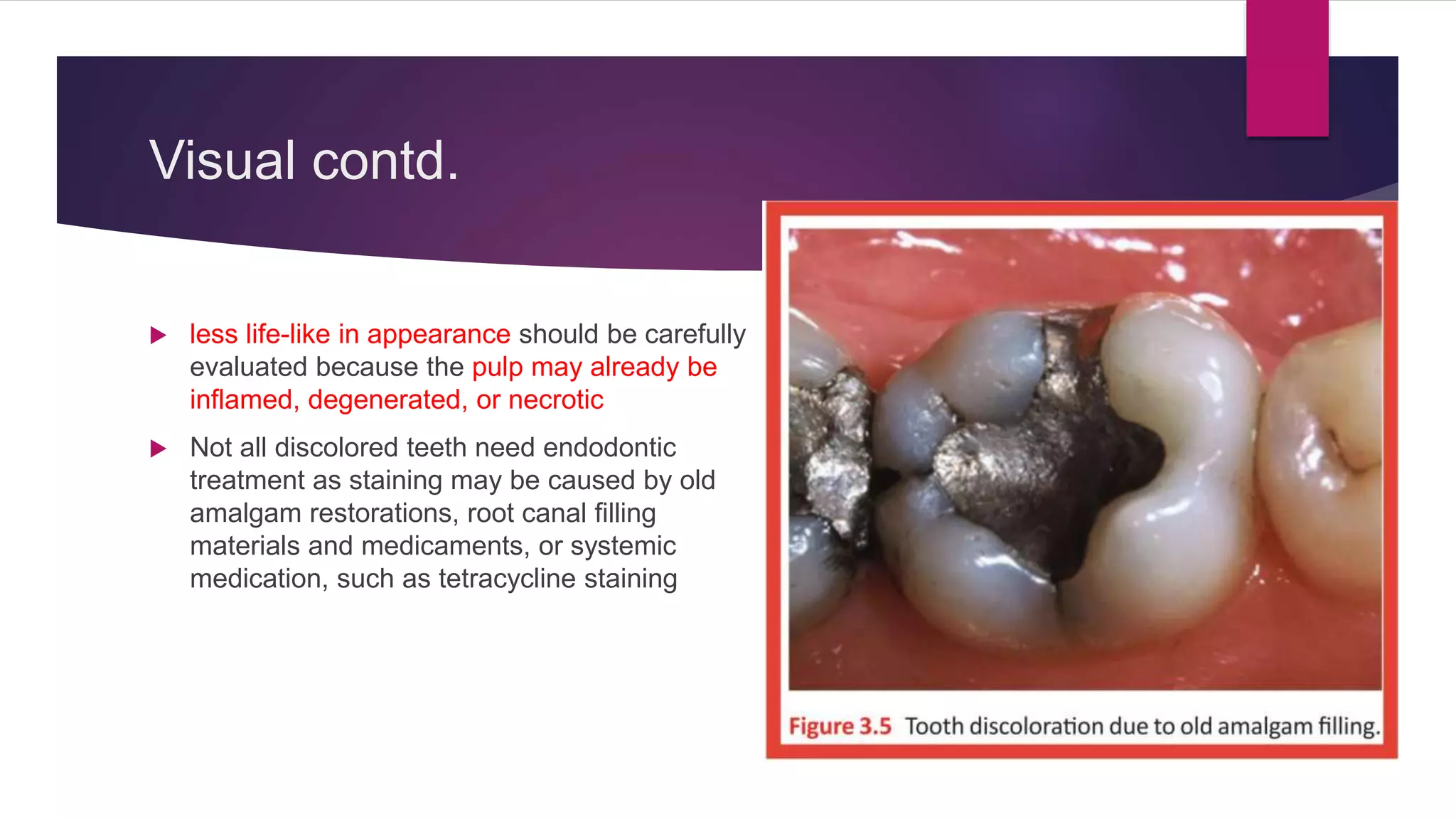 Diagnostic Aids in Endodontics | PPTX
