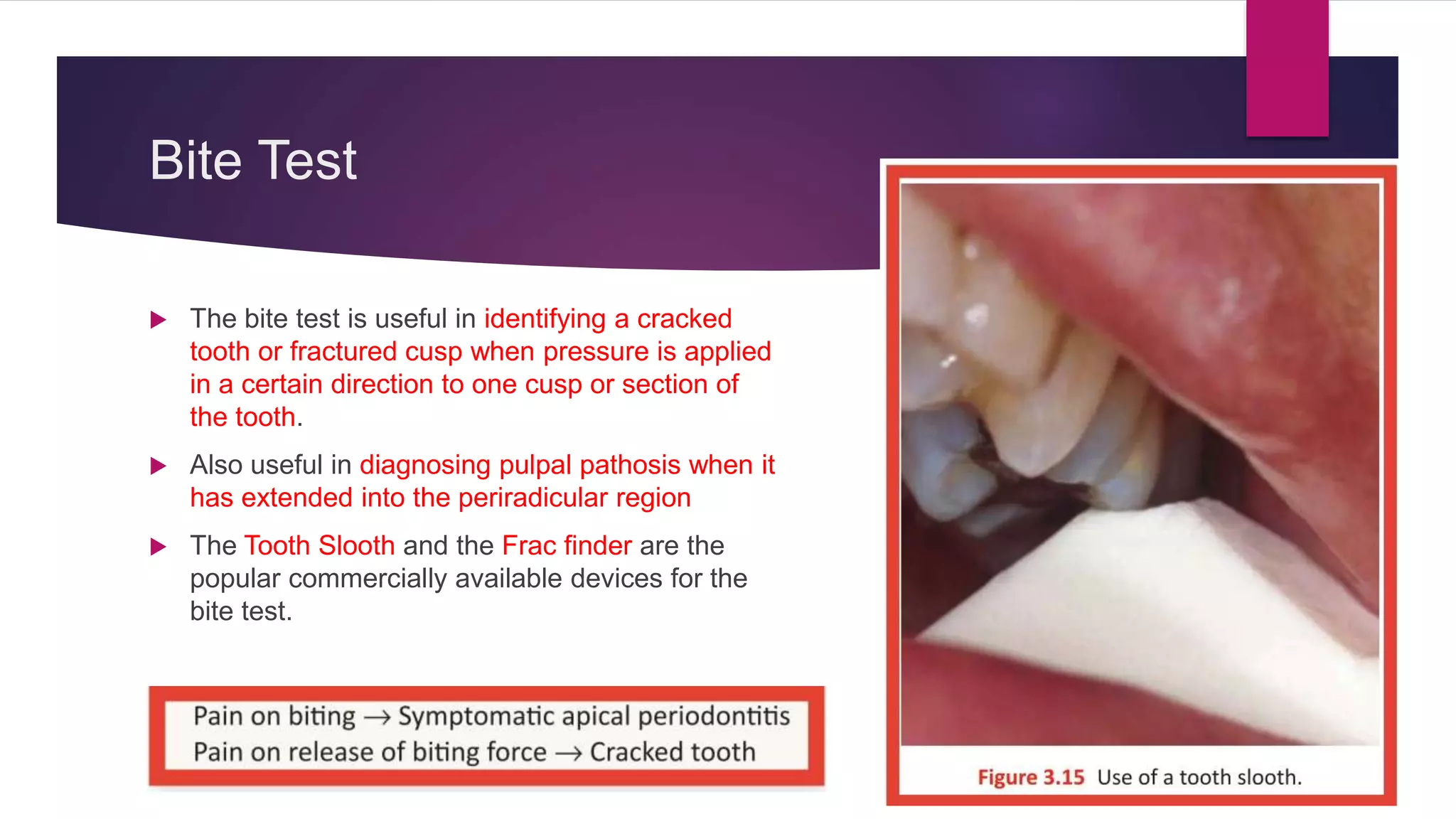 Diagnostic Aids in Endodontics | PPTX