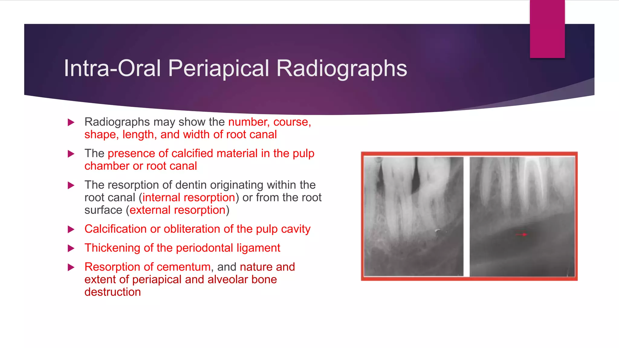 Diagnostic Aids in Endodontics | PPTX