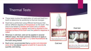 Diagnostic Aids in Endodontics | PPTX