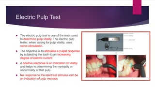 Diagnostic Aids in Endodontics | PPTX