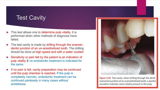 Diagnostic Aids in Endodontics | PPTX | Dental Health | Diseases and ...