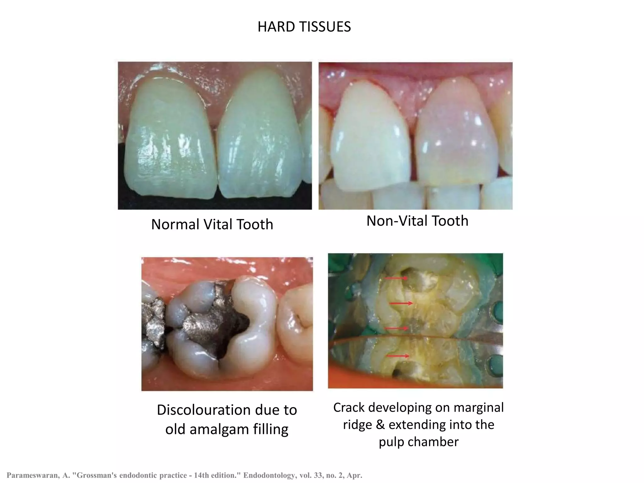 Diagnostic Aids in Endodontics | PPTX