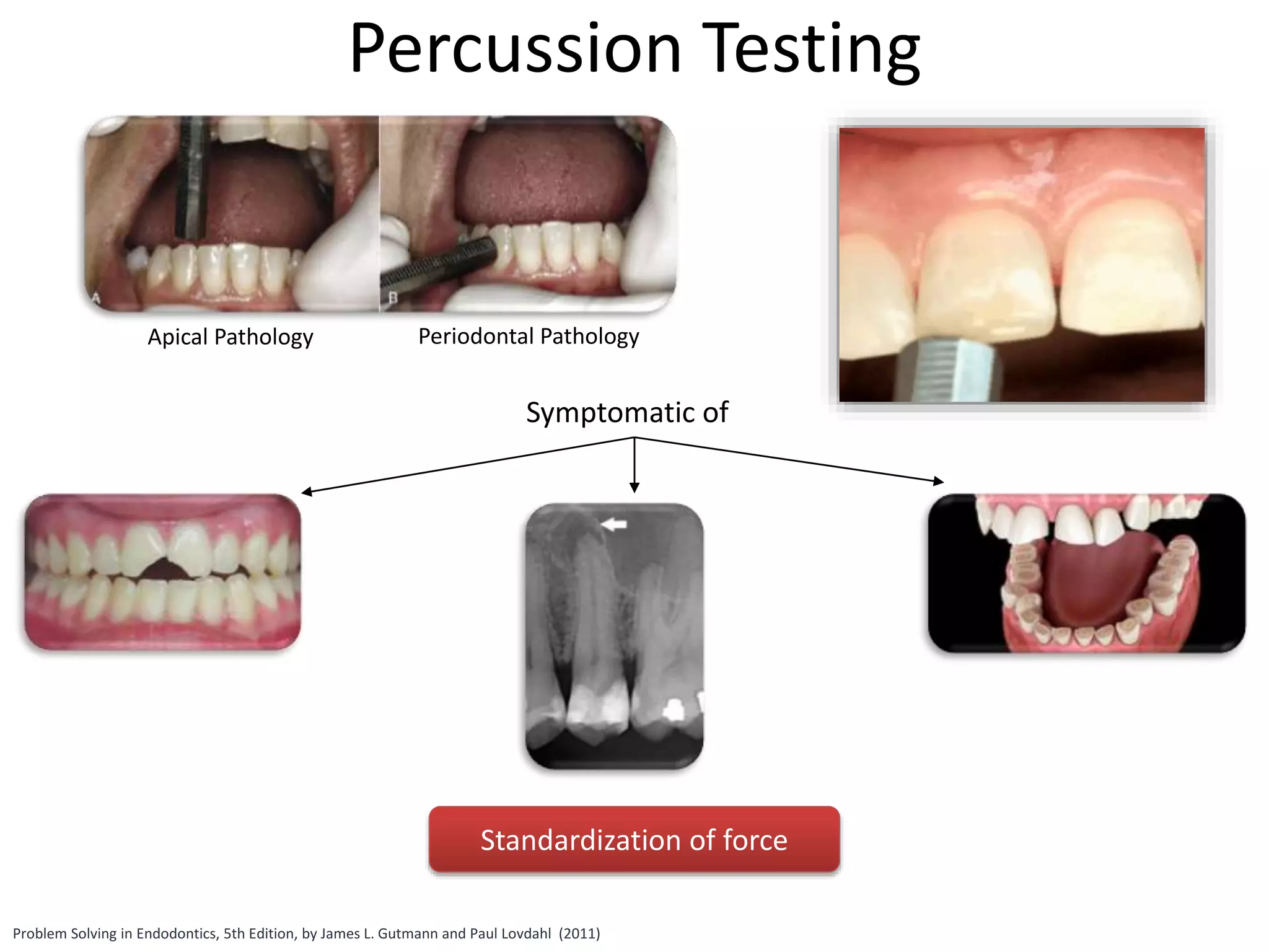 Diagnostic Aids in Endodontics | PPTX
