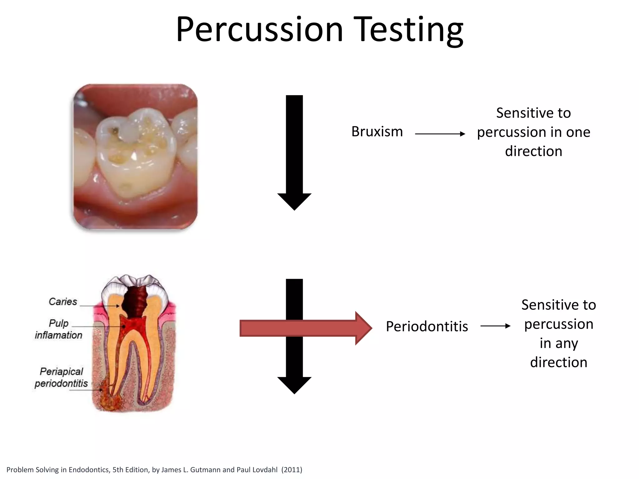 Diagnostic Aids in Endodontics | PPTX