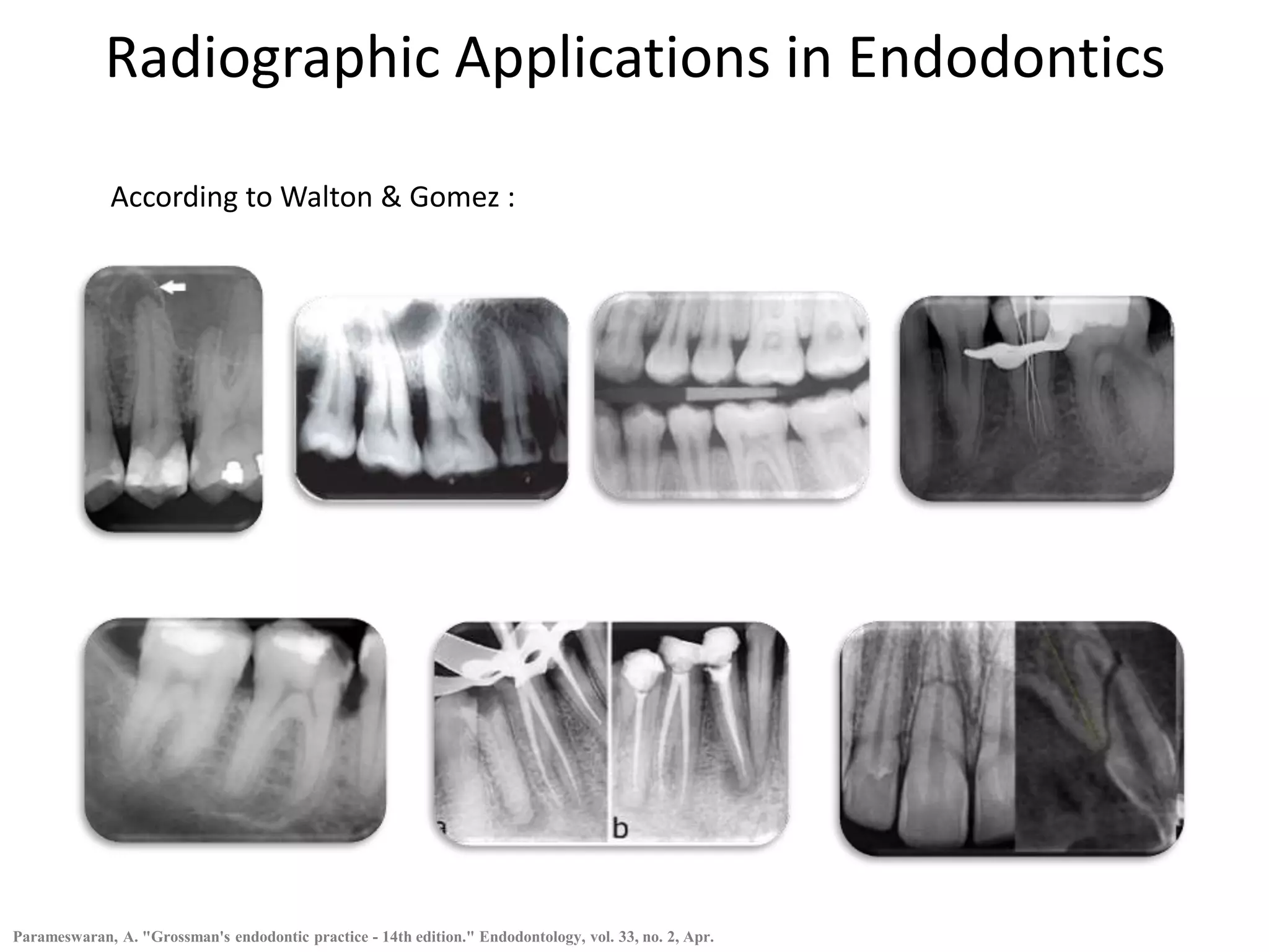 Diagnostic Aids in Endodontics | PPTX