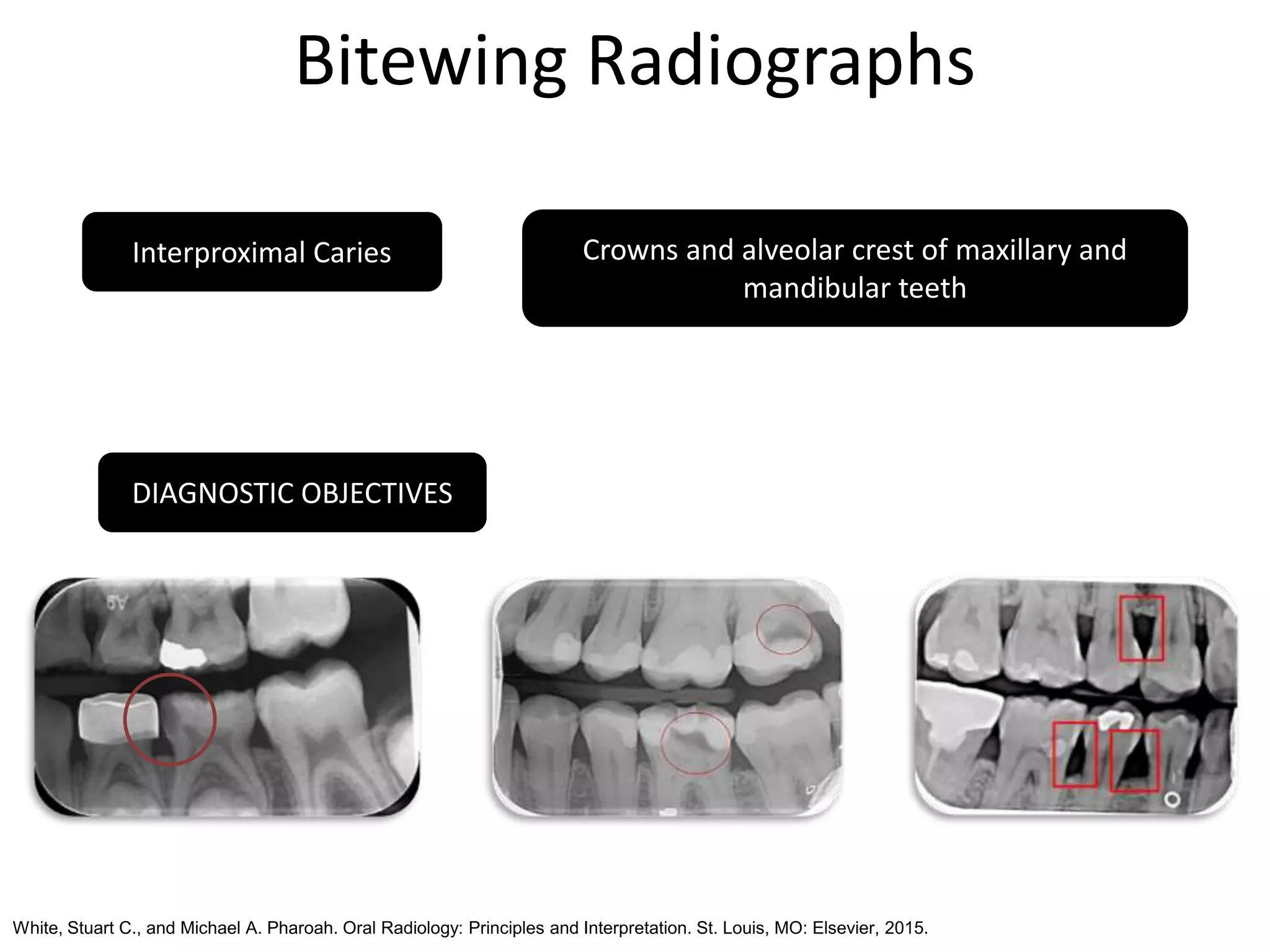 Diagnostic Aids in Endodontics | PPTX