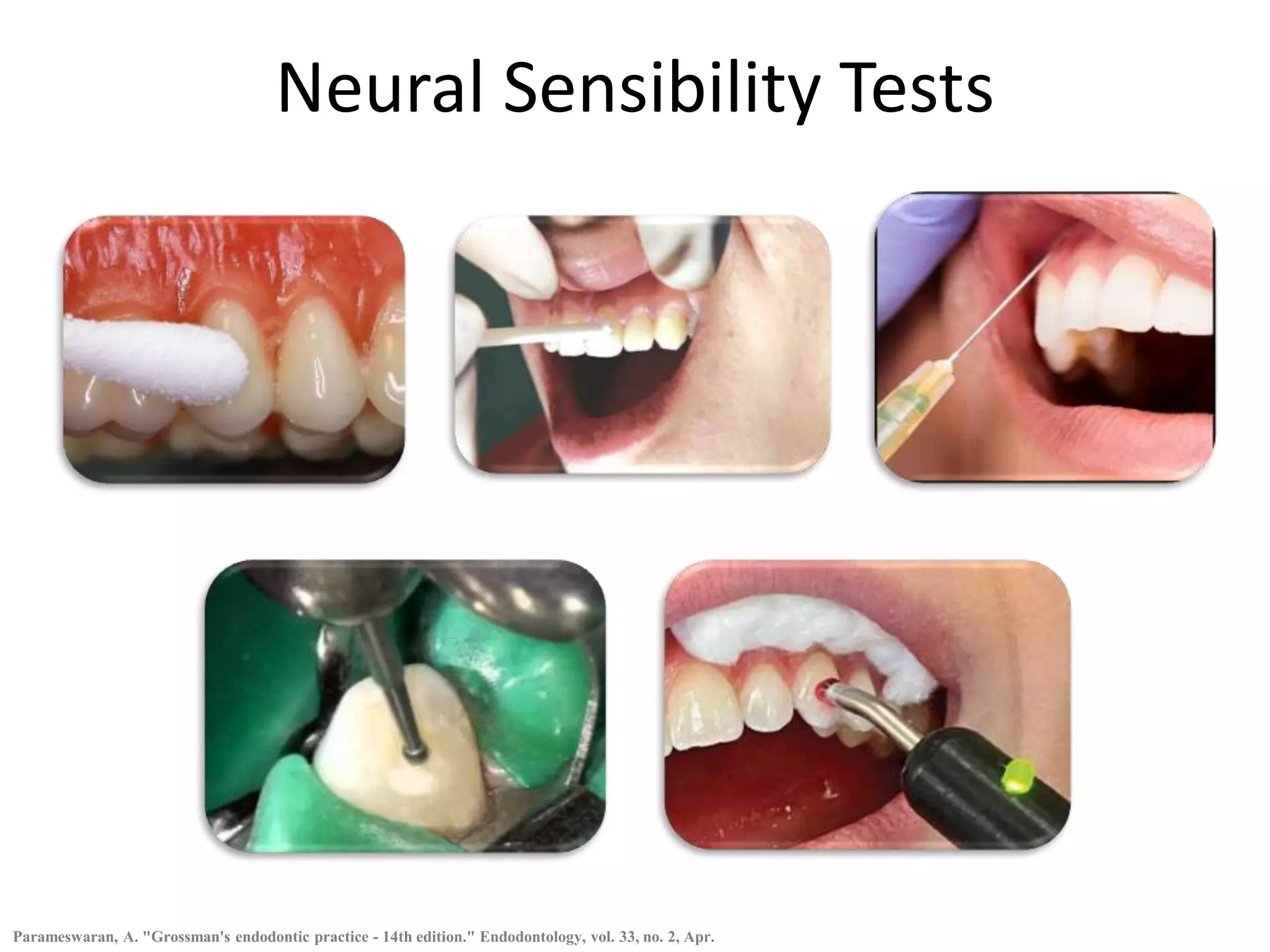 Diagnostic Aids in Endodontics | PPTX