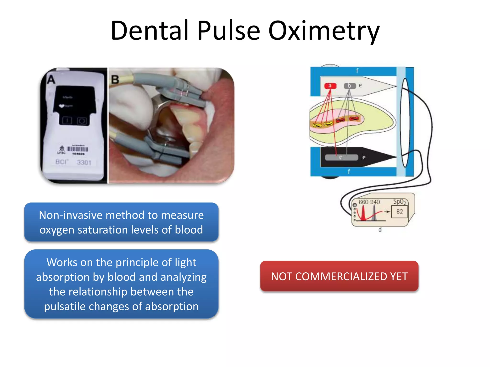 Diagnostic Aids in Endodontics | PPTX
