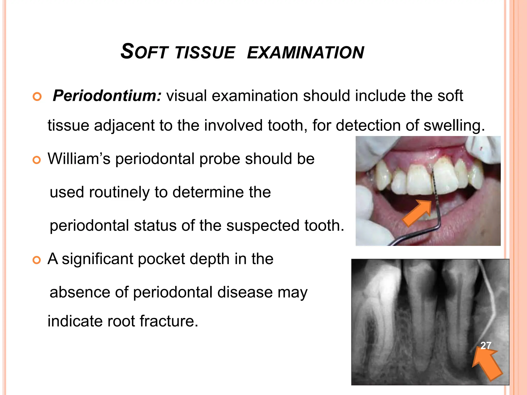 DIAGNOSTIC AIDS IN ENDODONTICS ppt.pptx