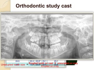 Diagnostic aids in_orthodontics | PPTX