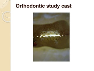 Diagnostic aids in_orthodontics | PPTX