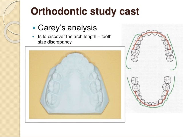 Diagnostic aids in_orthodontics
