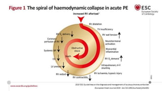 Diagnostic Algorithm for Acute Pulmonary Embolism.pptx