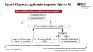 Diagnostic Algorithm for Acute Pulmonary Embolism.pptx