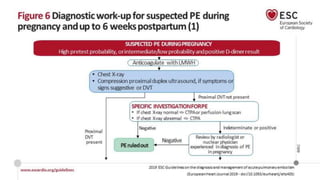 Diagnostic Algorithm for Acute Pulmonary Embolism.pptx