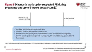 Diagnostic Algorithm for Acute Pulmonary Embolism.pptx