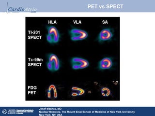 diagnosticando_la_cardiopatia_isquemica (2).ppt
