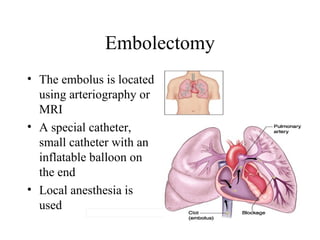 Diagnostic and surgical procedures for the treatment of | PPT