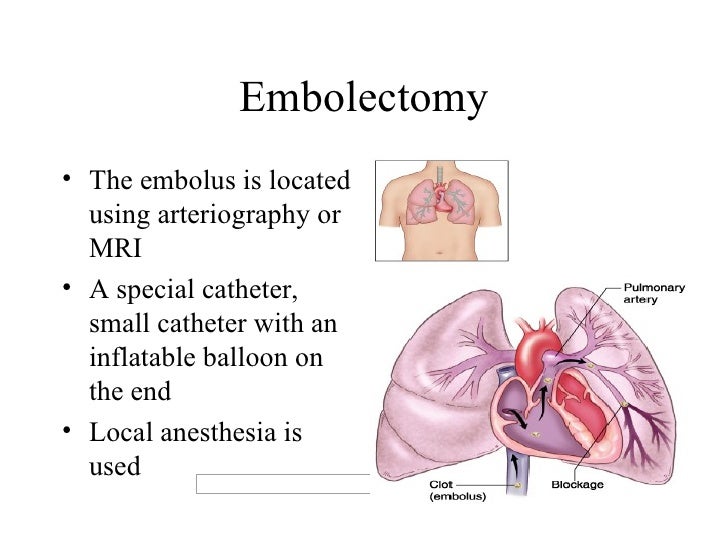 Diagnostic and surgical procedures for the treatment of