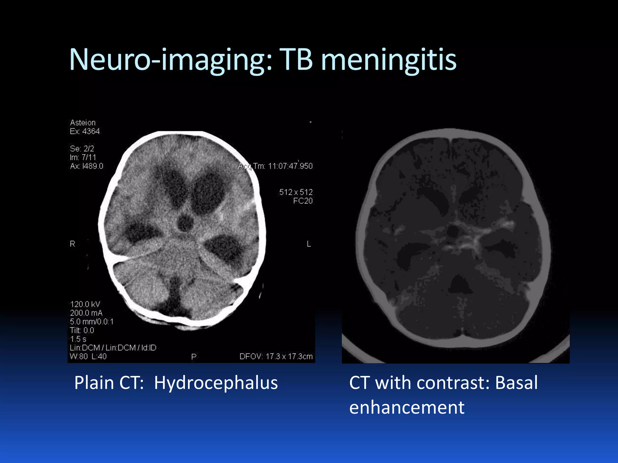Diagnostic approach to acute encephalopathy | PDF