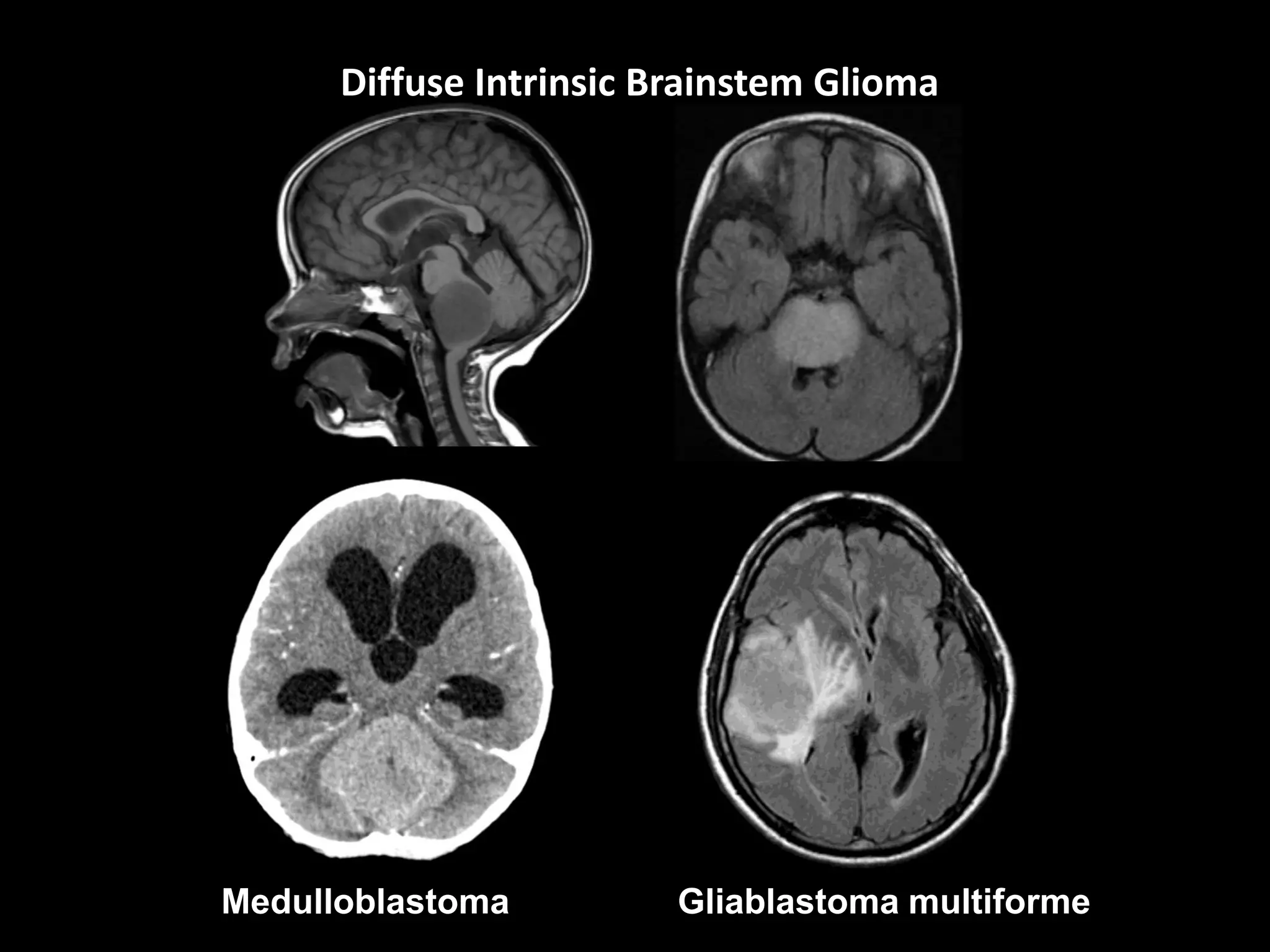 Diagnostic approach to acute encephalopathy | PDF