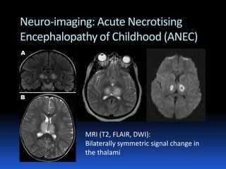 Diagnostic approach to acute encephalopathy | PDF