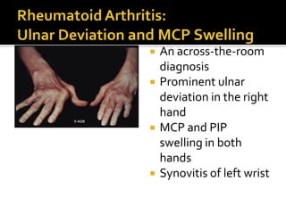 Diagnostic approach to musculoskeletal pain | PDF