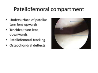 Knee Portal Placement & Diagnostic arthroscopy | PPTX
