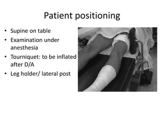 Knee Portal Placement & Diagnostic arthroscopy | PPTX