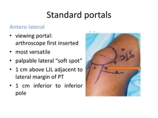 Knee Portal Placement & Diagnostic arthroscopy | PPTX