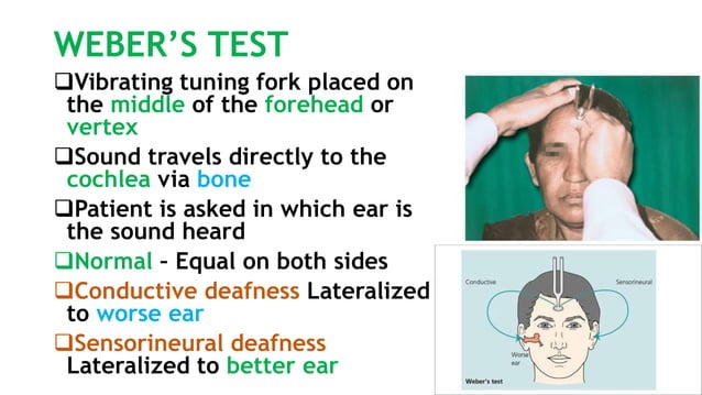 diagnostic audiology, audiometry, tympanometry and OAE.pptx | Ear, Nose ...