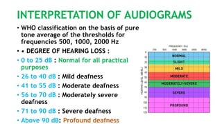 diagnostic audiology, audiometry, tympanometry and OAE.pptx