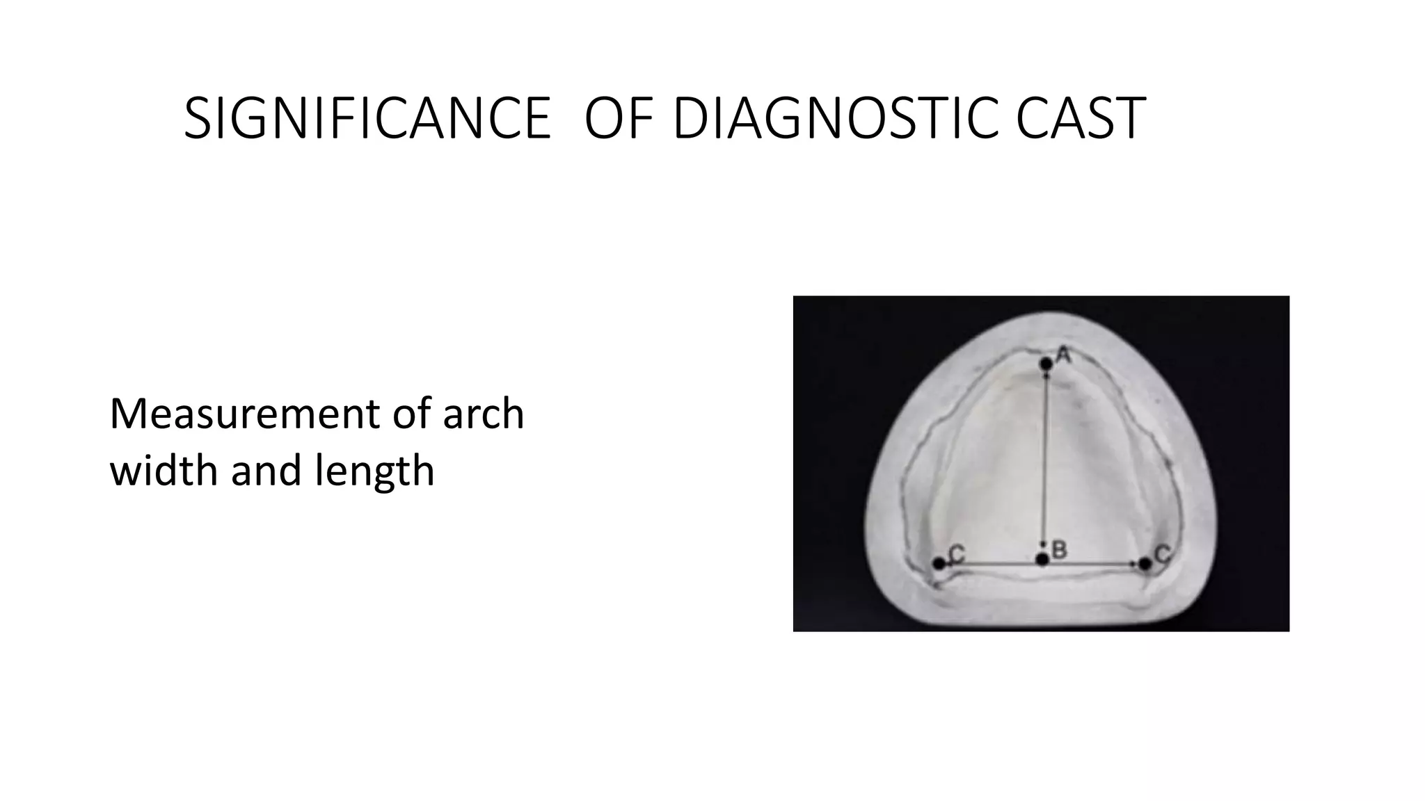 Diagnostic cast.pptx
