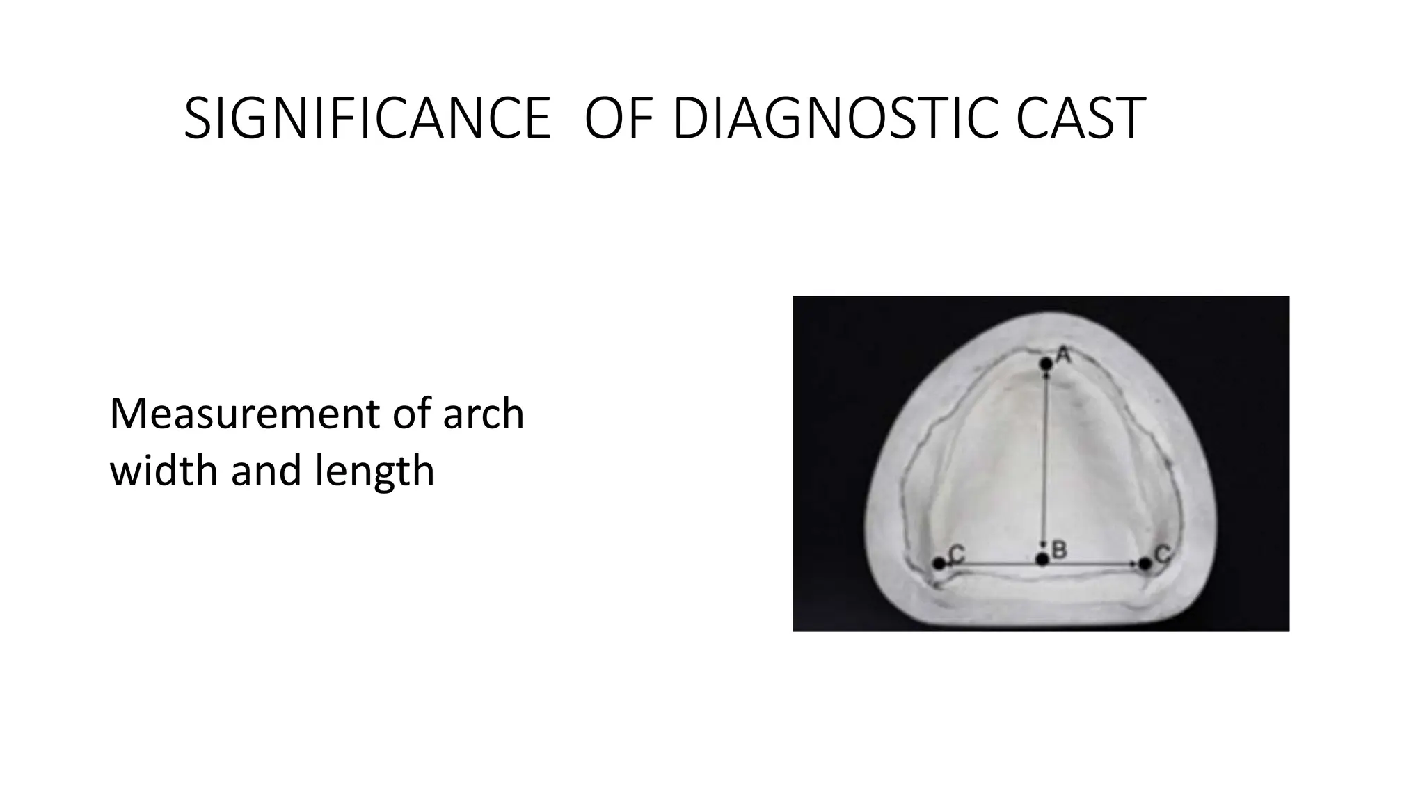 Diagnostic cast FOR COMPLETE DENTURES pptx | PPTX
