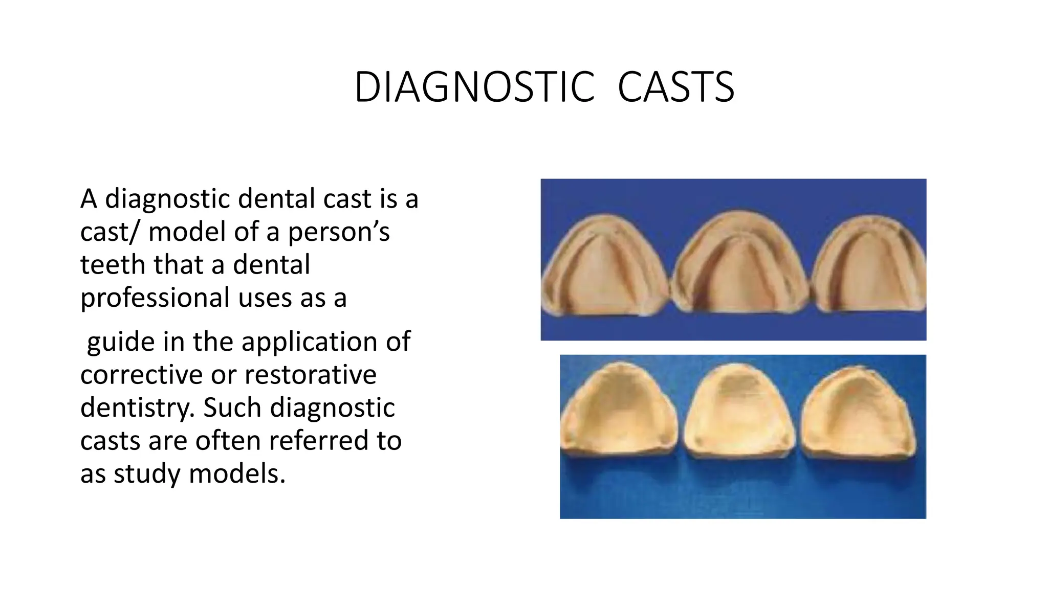 Diagnostic cast FOR COMPLETE DENTURES pptx | PPTX