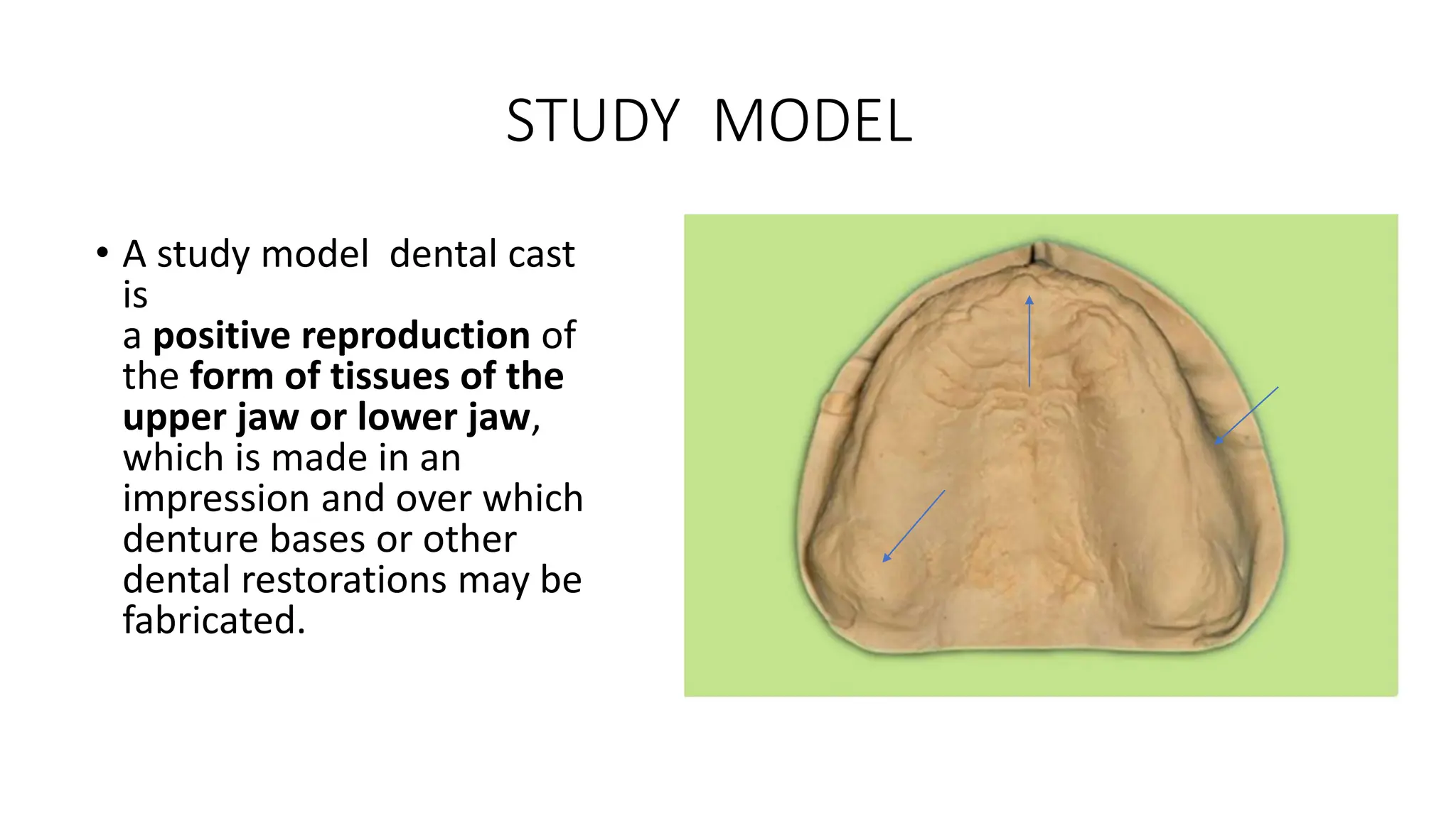 Diagnostic cast FOR COMPLETE DENTURES pptx | PPTX