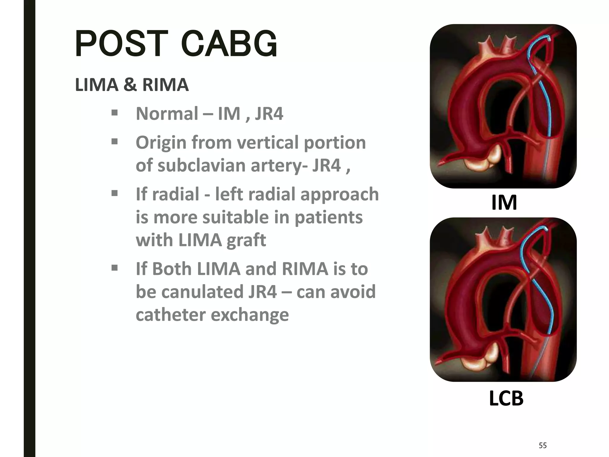 Diagnostic catheters for coronary angiography | PPTX