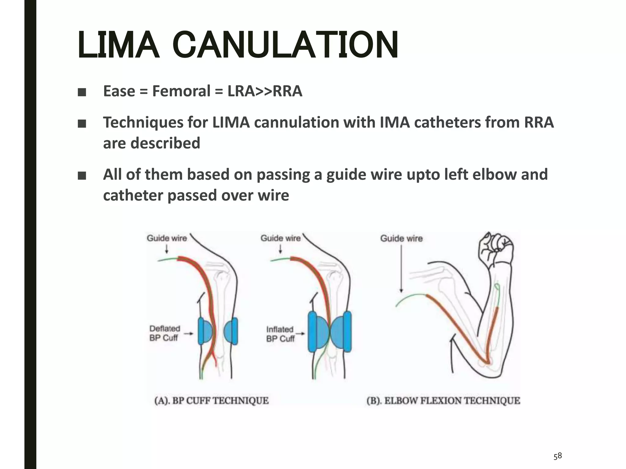 Diagnostic catheters for coronary angiography | PPTX