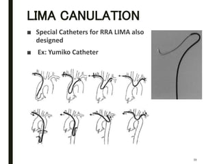 Diagnostic catheters for coronary angiography | PPTX