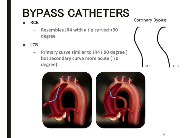 Diagnostic catheters for coronary angiography