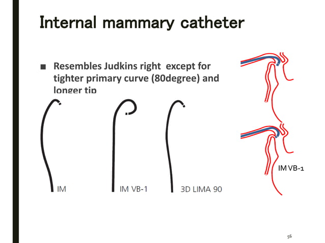 Diagnostic catheters for coronary angiography