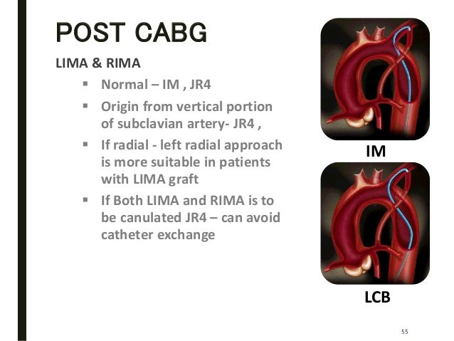 Diagnostic catheters for coronary angiography