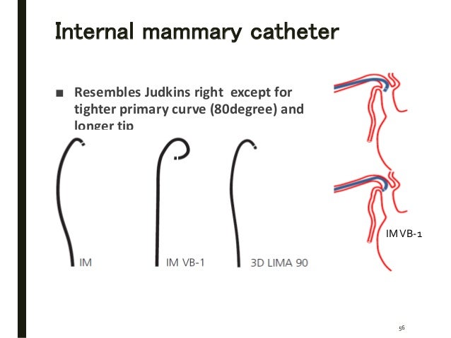 Diagnostic catheters for coronary angiography