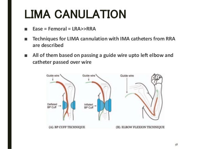 Diagnostic catheters for coronary angiography