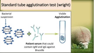 Diagnosis of brucellosis | PPTX