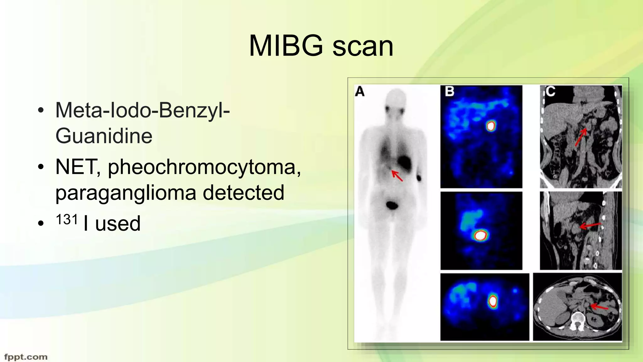 diagnostic evaluation for malignent disease.pptx